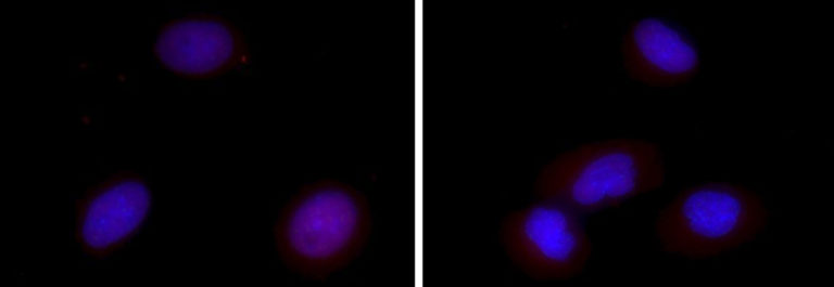 Gene Editing Institute takes next step to advance lung cancer trial ...