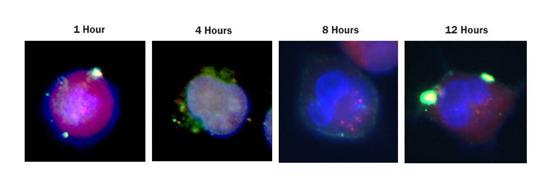 Gene Editing Institute takes next step to advance lung cancer trial ...