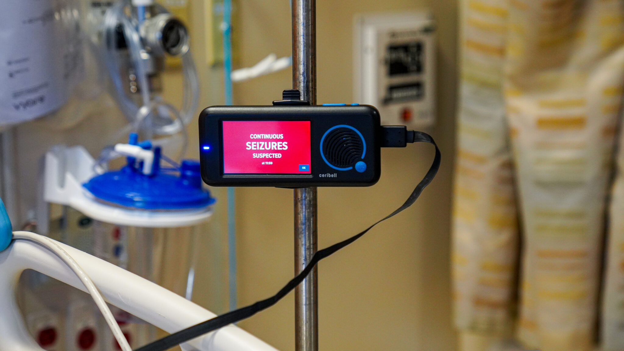 New EEG Brain Monitoring Reduces Seizure Diagnosis From Hours to ...