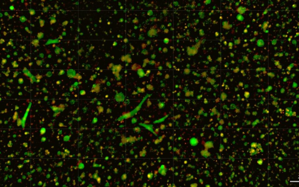 ChristianaCare Launches Organoid Core to Personalize Cancer Treatment ...
